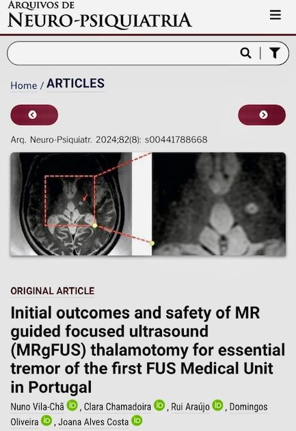 Initial outcomes and safety of MR guided focused ultrasound (MRgFUS ...